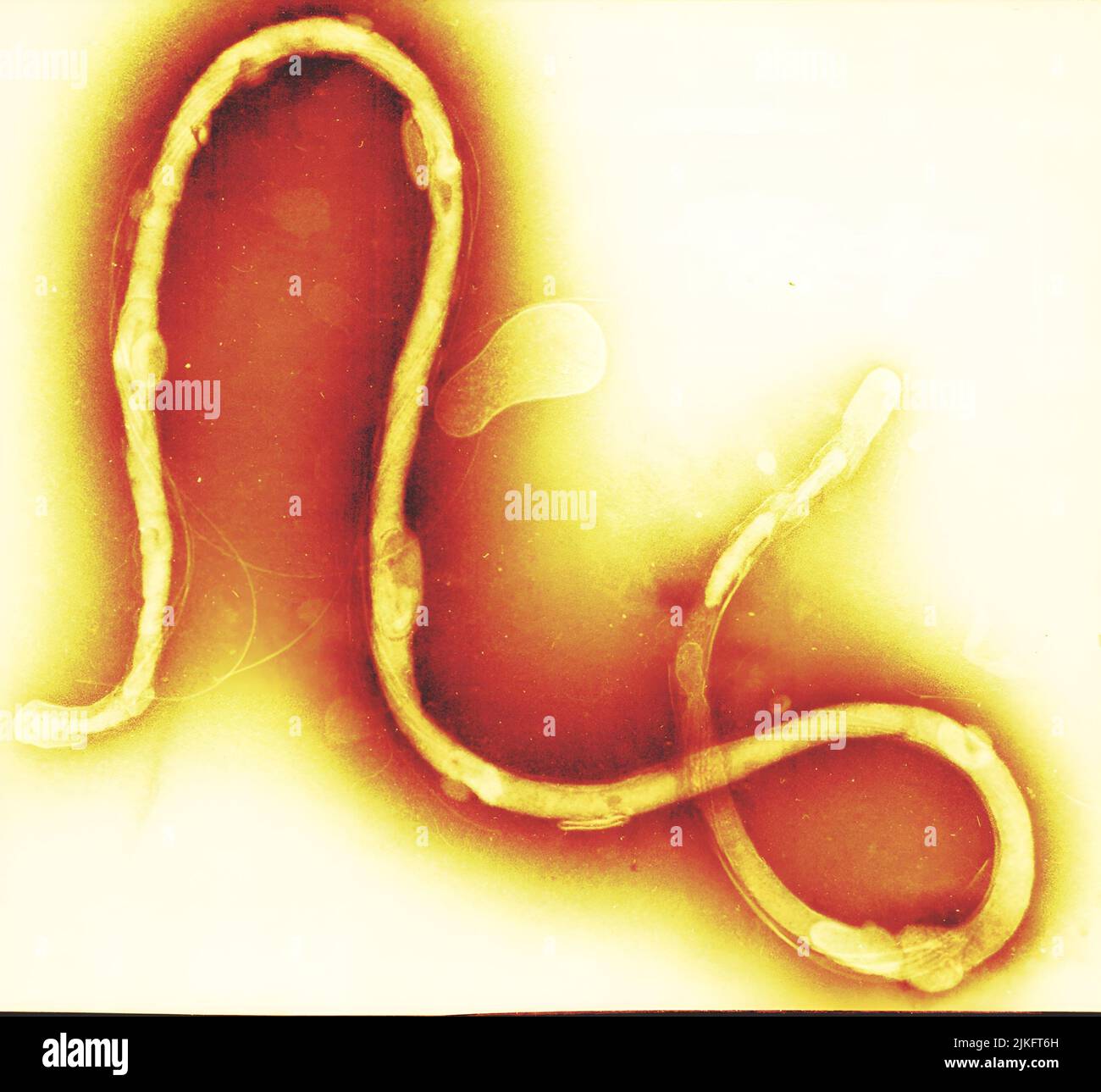 Borrelia burgdorferi is a spirochete, a class of long, choppy bacteria ...
