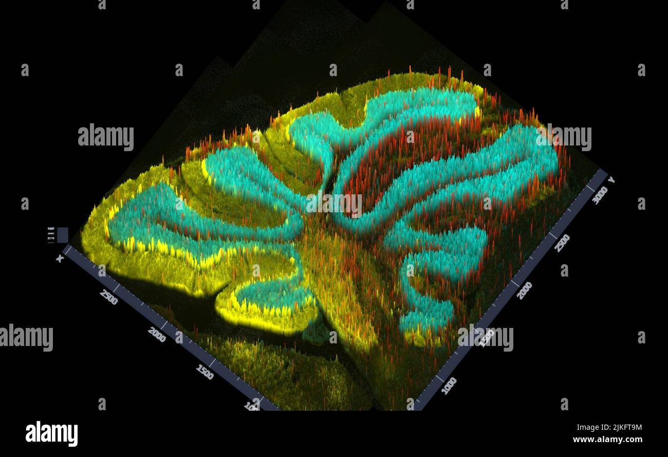 In a mouse model of Niemann-Pick type C disease, the cerebellum is ...