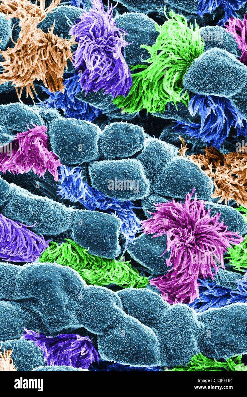 In this image, the community of cells lining the airways of a mouse is ...