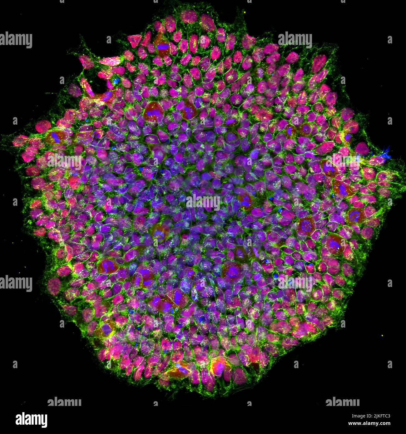 Albinism eyes hi-res stock photography and images - Alamy