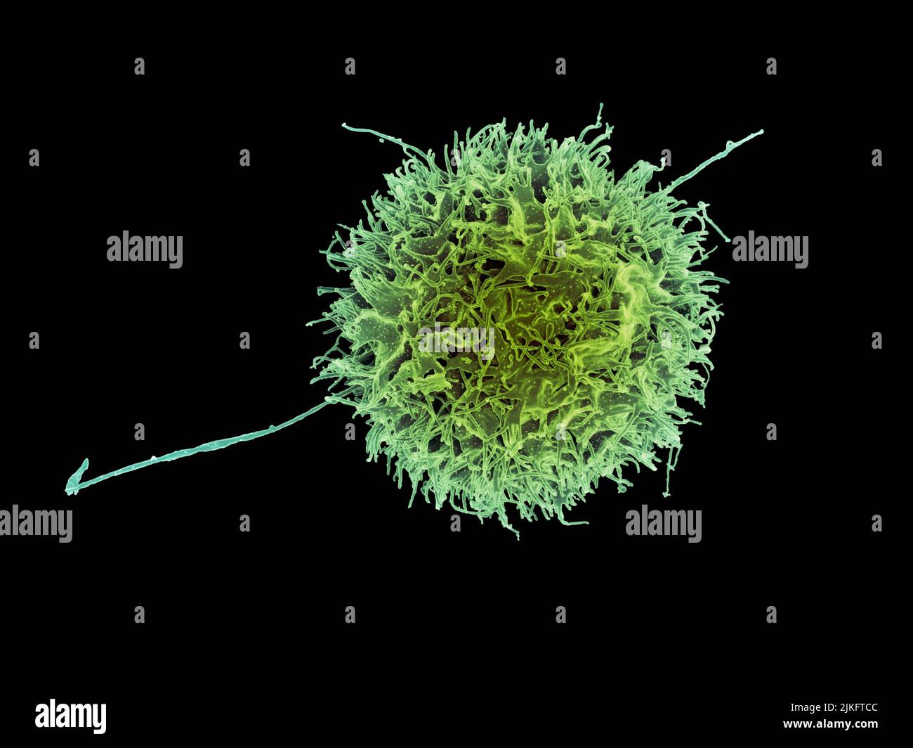 Colorized scanning electron micrograph of a natural killer cell from a ...