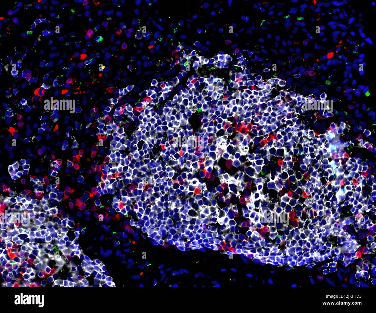 Innate lymphoid cells (green) near and within a small area of ...