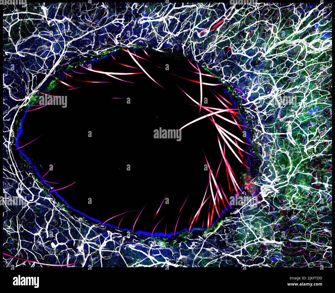 Immunofluorescent image of immune cells confined to a skin wound ...