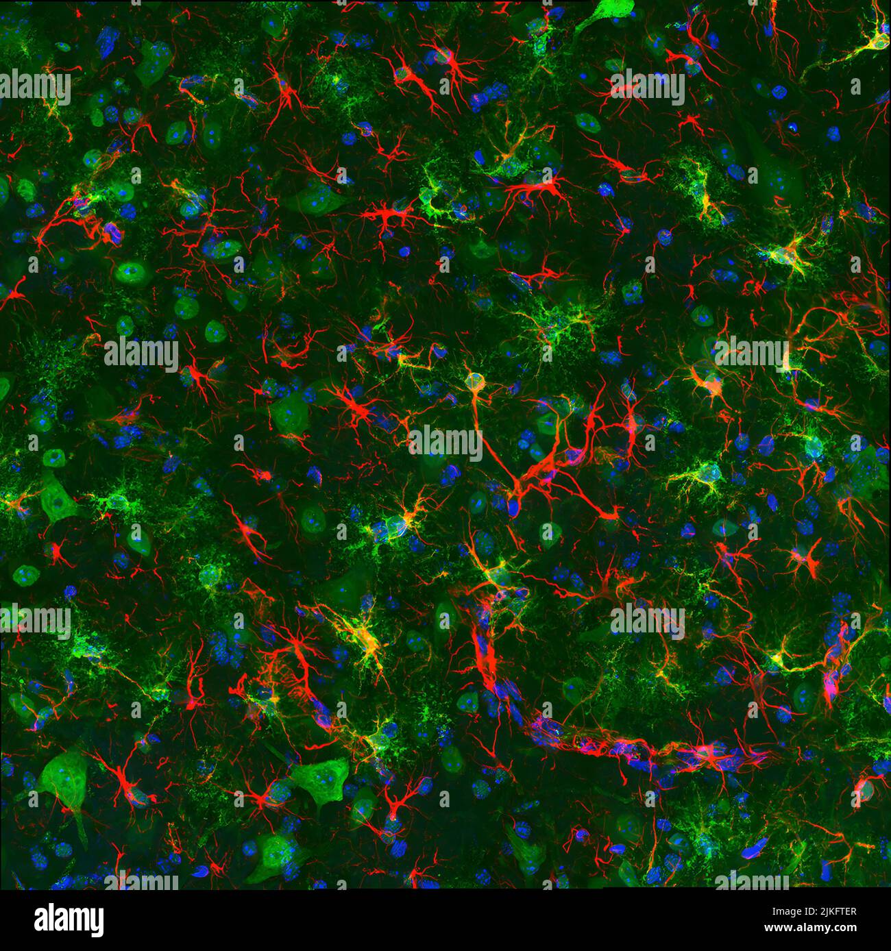 Human glial cell micrograph hi-res stock photography and images - Alamy