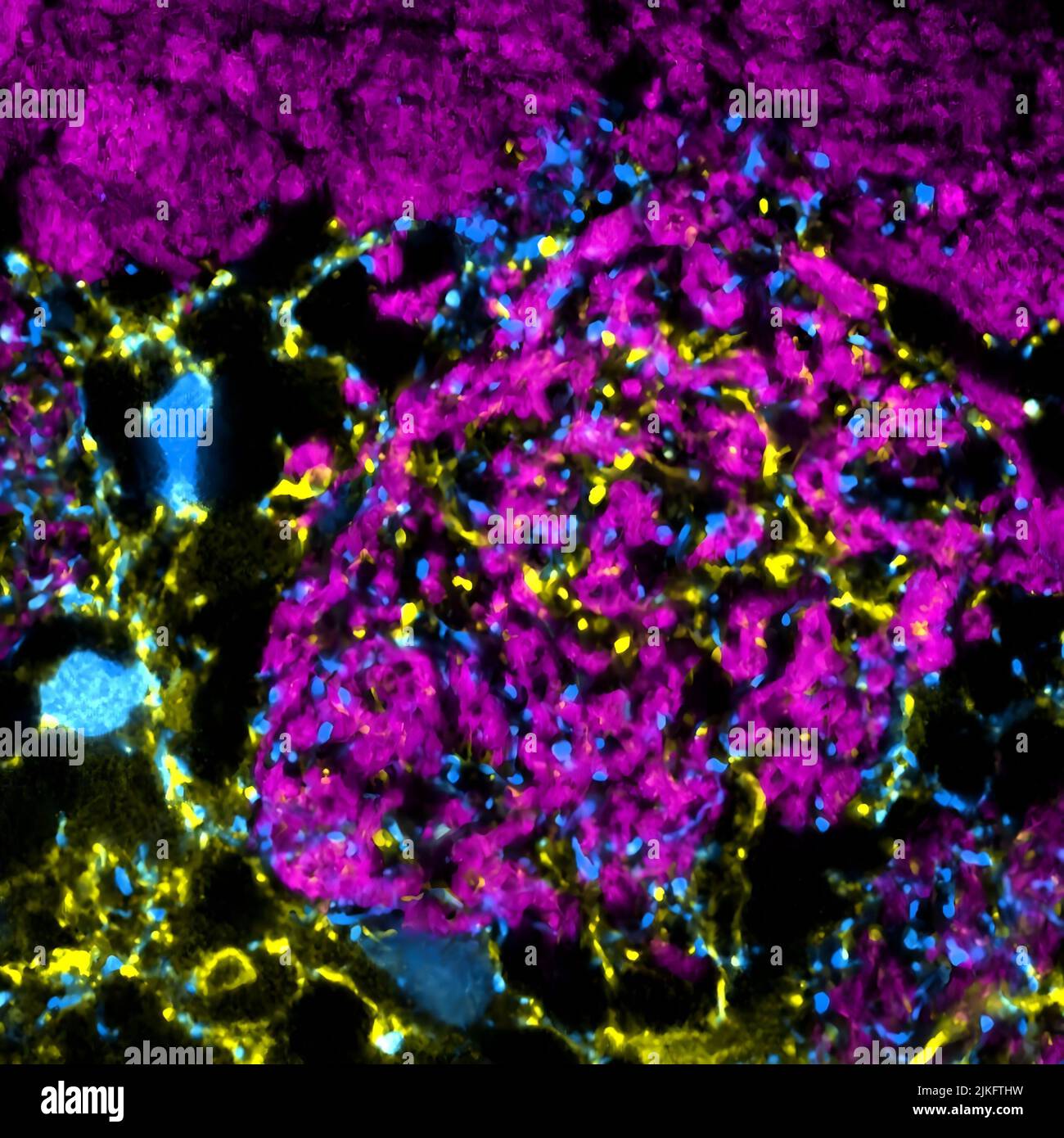 Smell-sensitive neurons form long connections (pink) that enter the ...