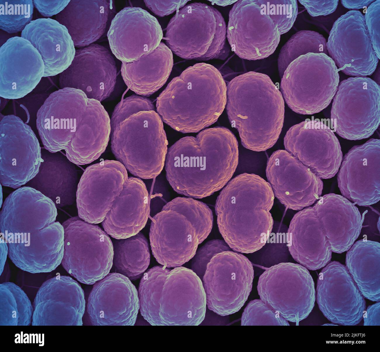 Colorized scanning electron micrograph of the bacterium Neisseria gonorrhoeae, which causes ...