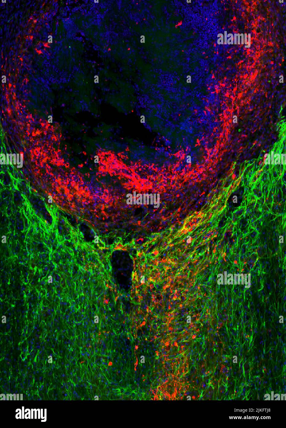 An NIH-funded mouse study suggests scar formation may help, not hinder ...