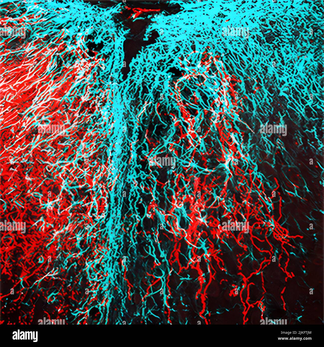 Spinal cord lesions hi-res stock photography and images - Alamy