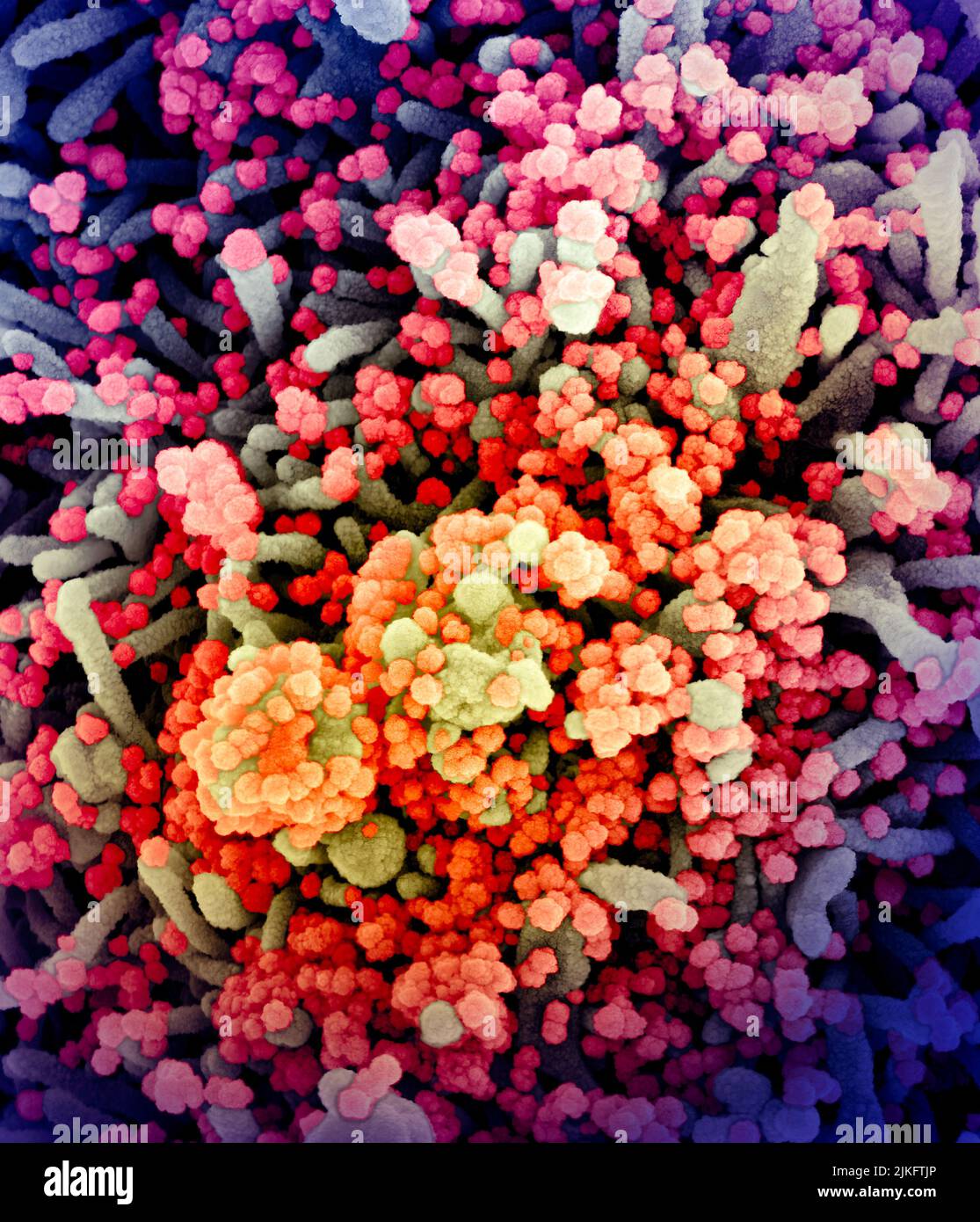 Scanning electron microscope image cov hi-res stock photography and ...