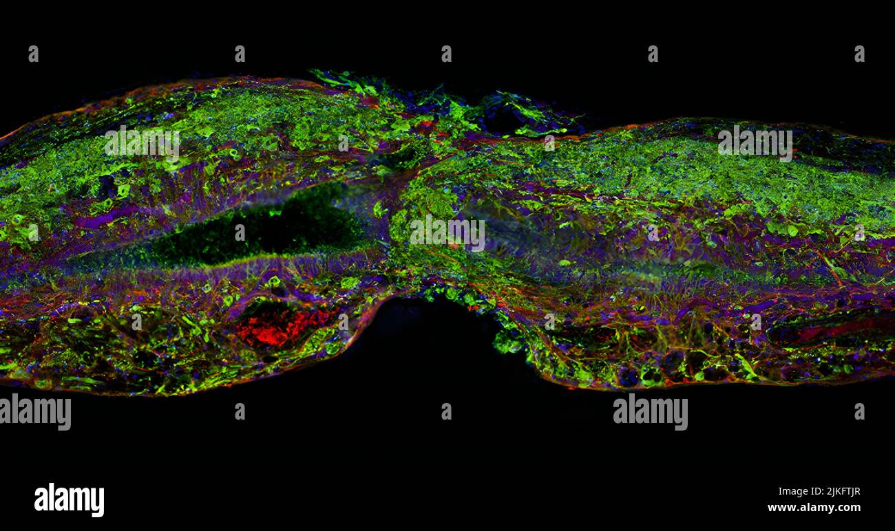 Zebrafish spinal cord tissue section regenerating after injury. Glial ...