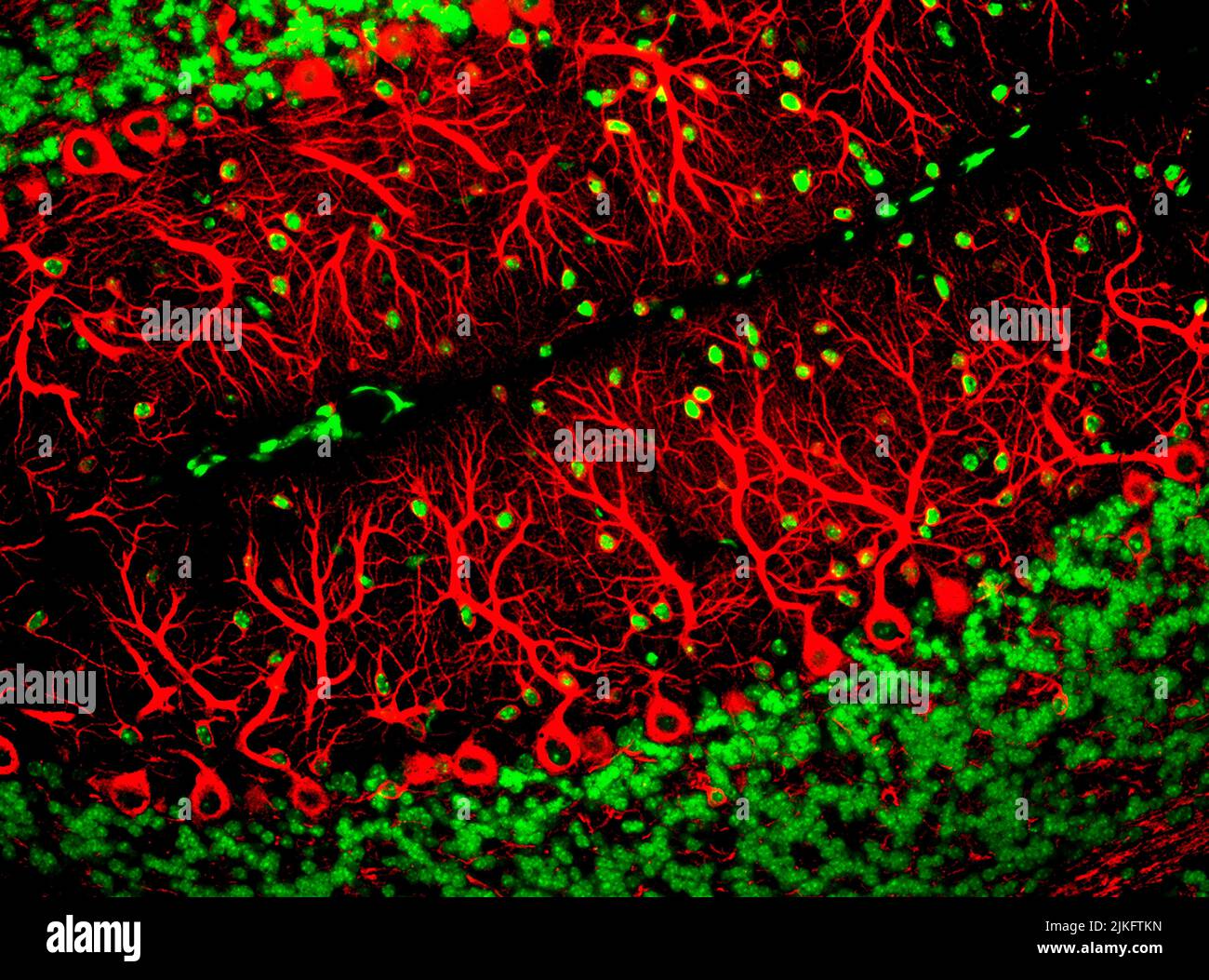 Types of nerve cells hi-res stock photography and images - Alamy