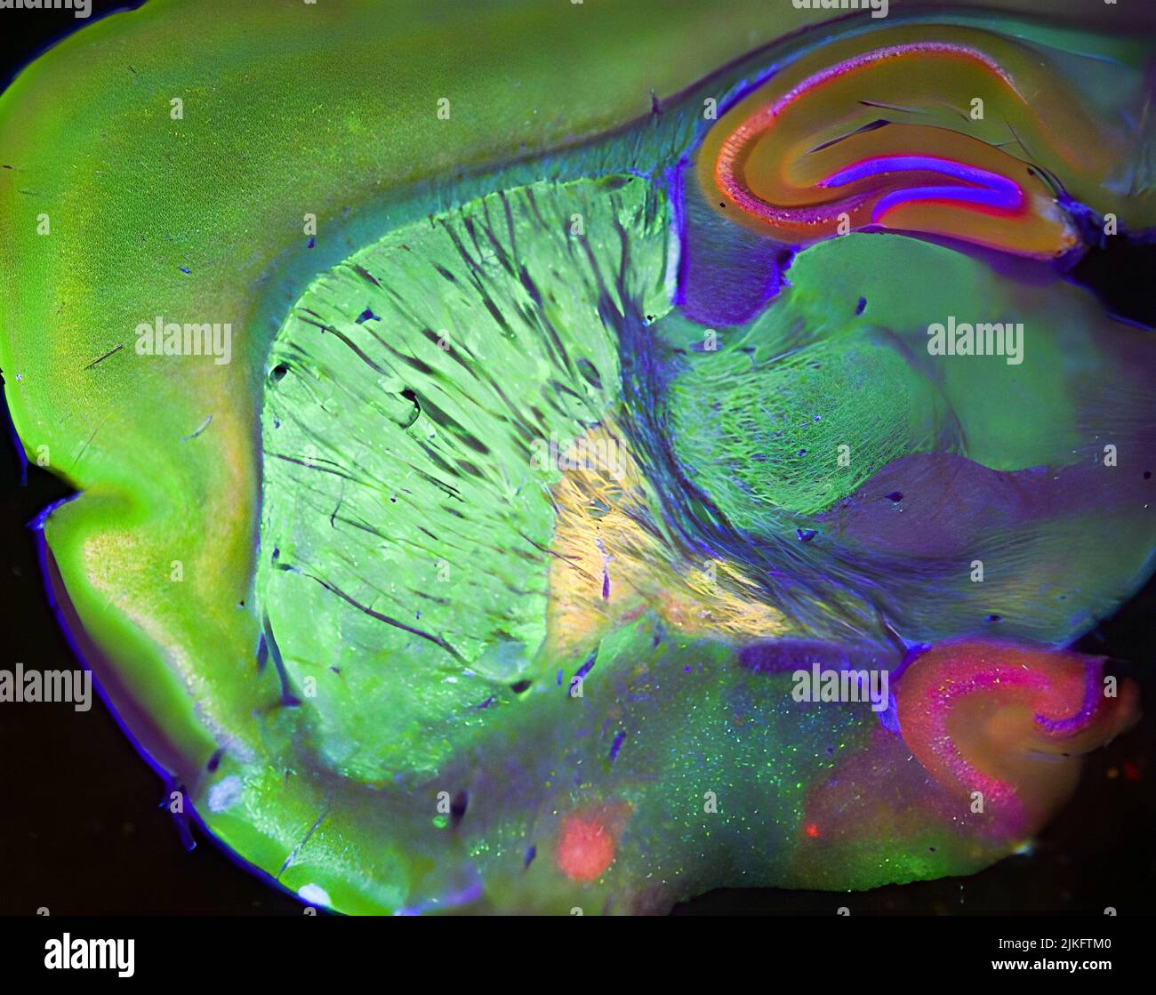 Sagittal section of Nr4a1-eGFP transgenic mouse stained for CB1 ...