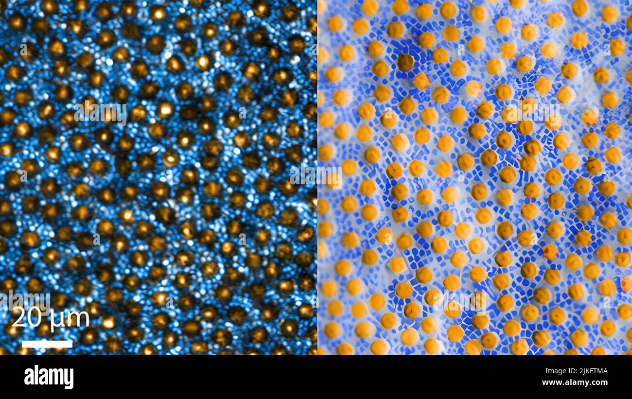 By looking through a patient's enlarged pupil during a dilated eye exam ...