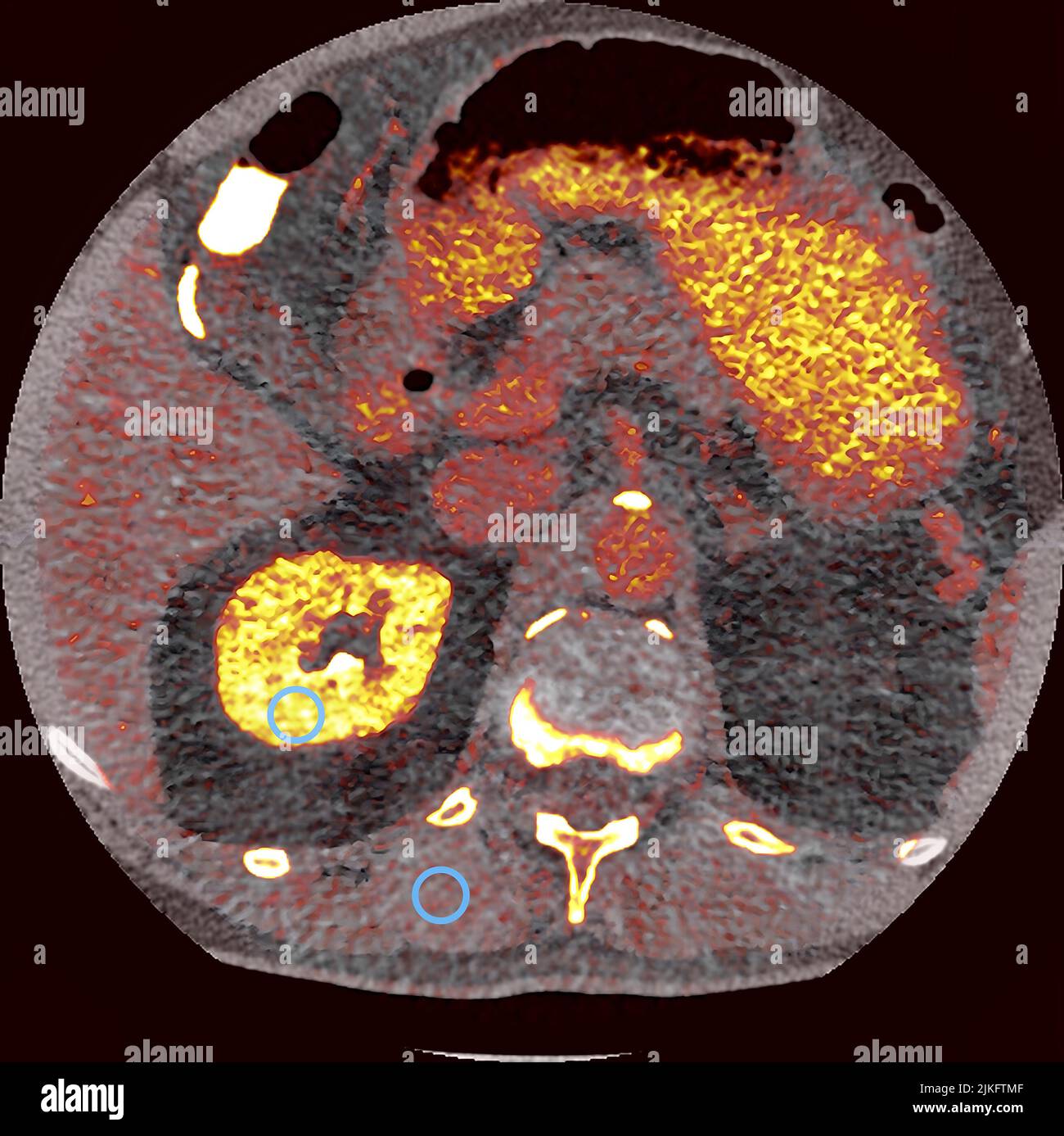Medical physics hi-res stock photography and images - Alamy
