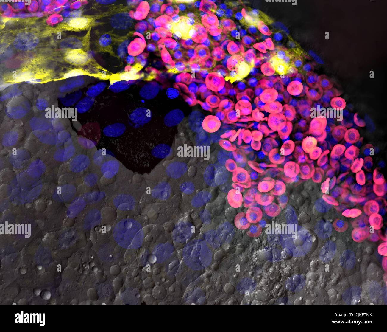 Micrograph of blood vessel hi-res stock photography and images - Alamy