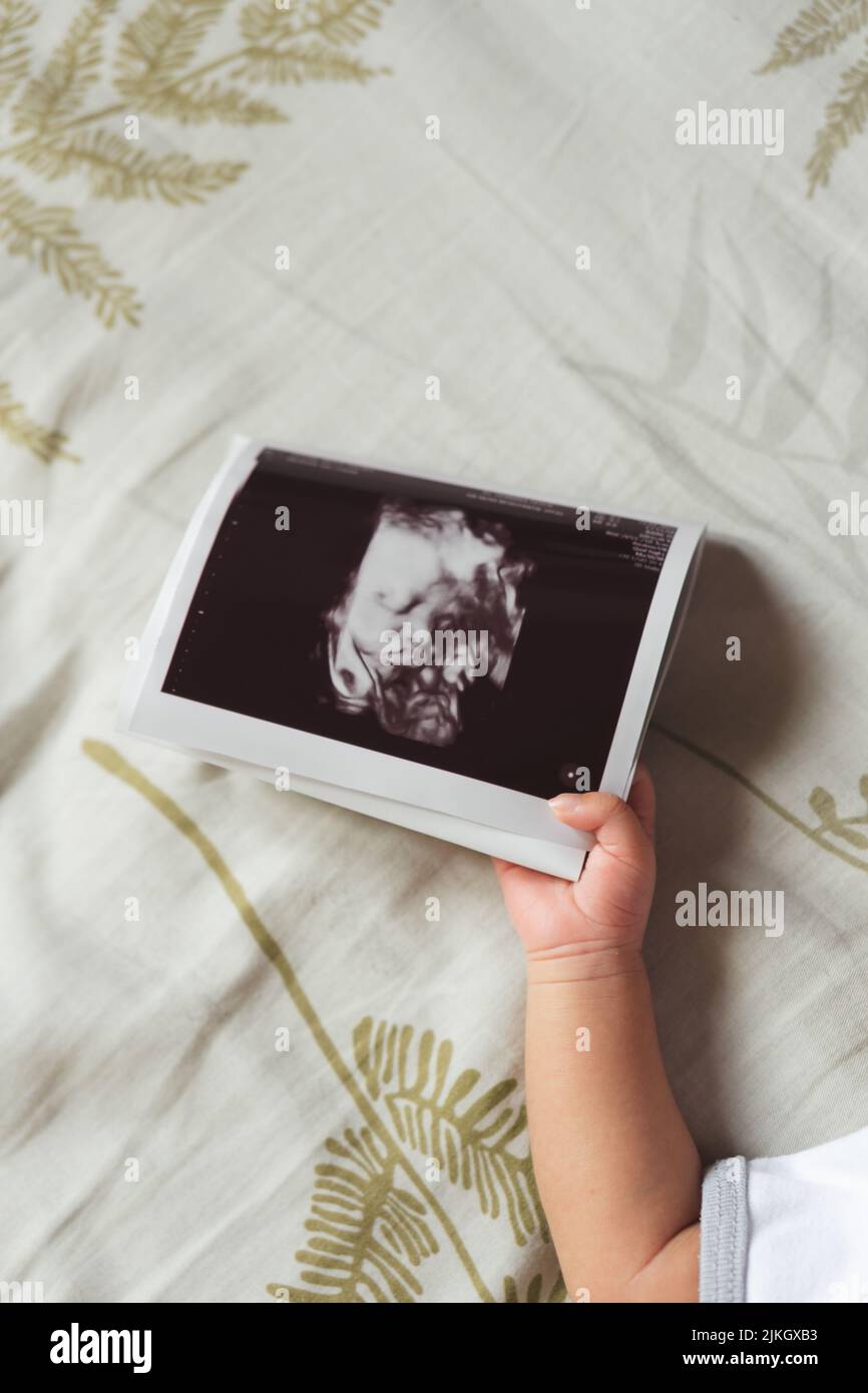 A vertical shot of a sonogram photo in a newborn baby's hand Stock ...