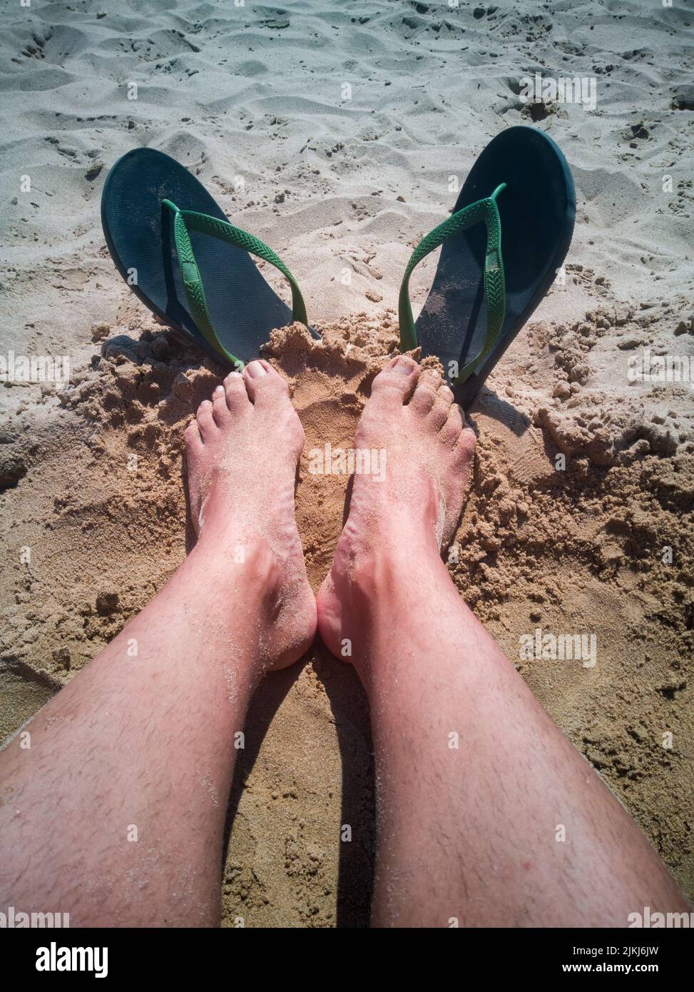 Sunburn on the feet with flip flops, vertical view from above Stock ...