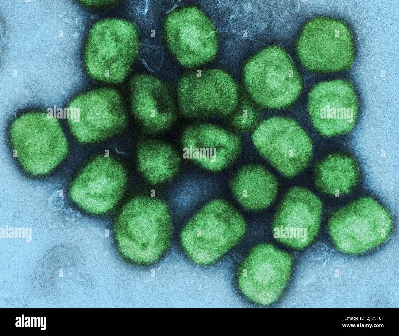Monkeypox Virus Colorized transmission electron micrograph of monkeypox ...