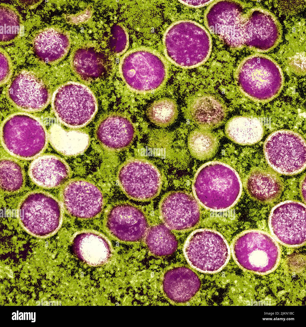 Monkeypox Virus Colorized transmission electron micrograph of monkeypox ...