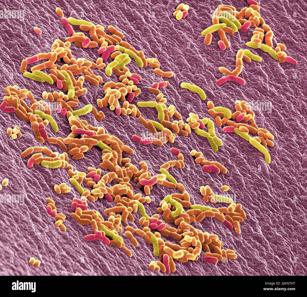 Lip microbiome, SEM Stock Photo - Alamy