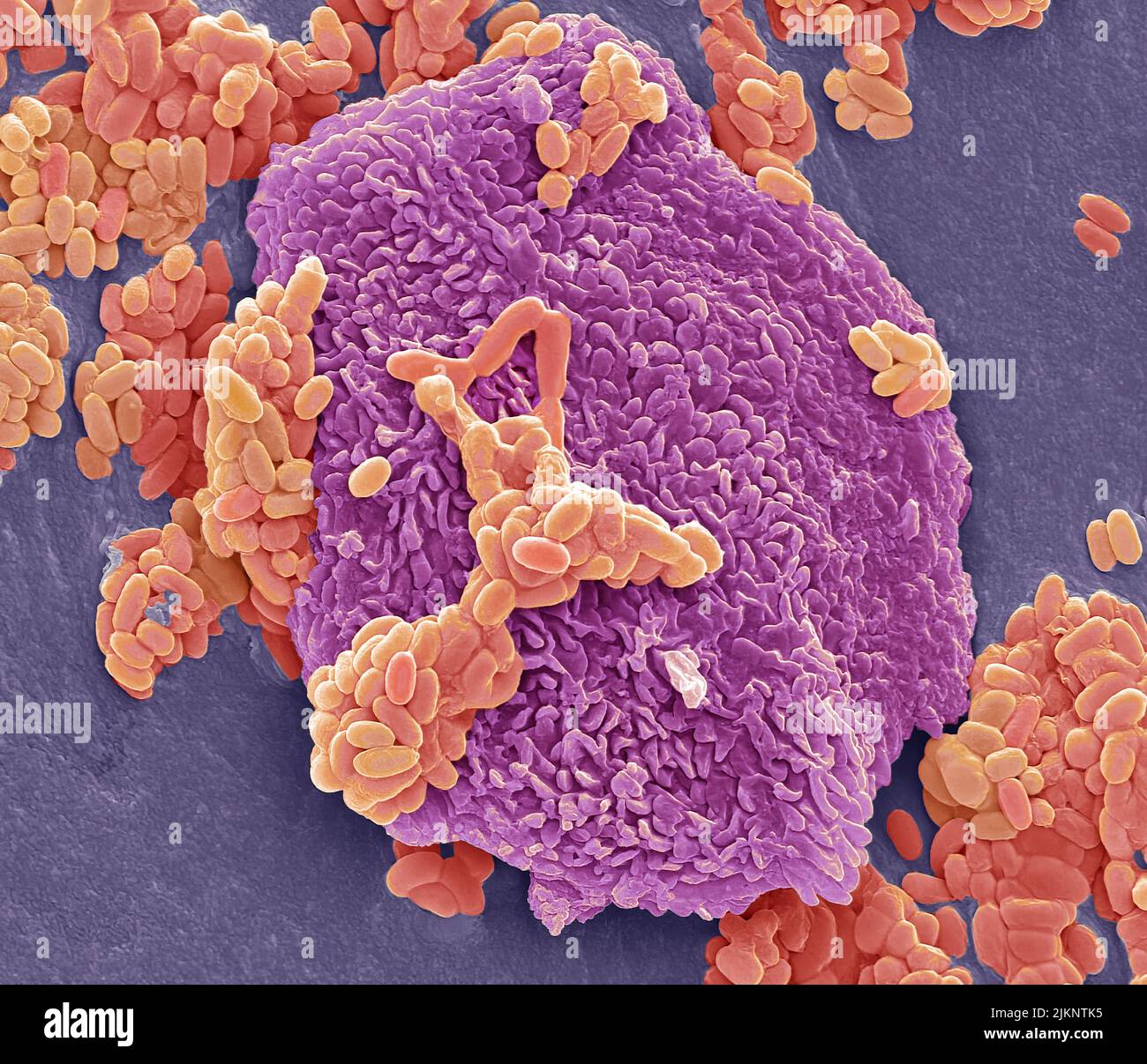Lip microbiome, SEM Stock Photo - Alamy
