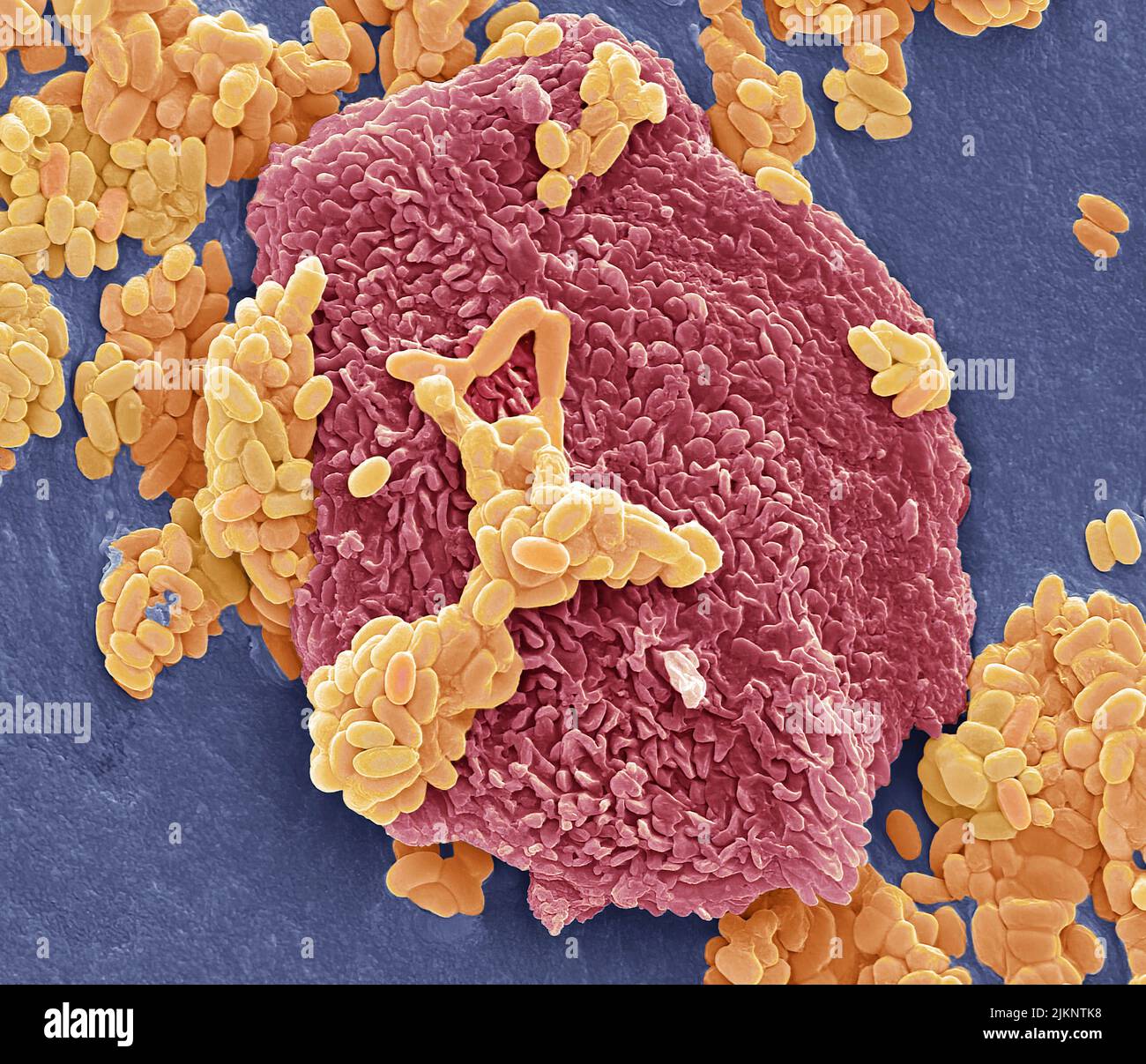 Lip microbiome, SEM Stock Photo - Alamy