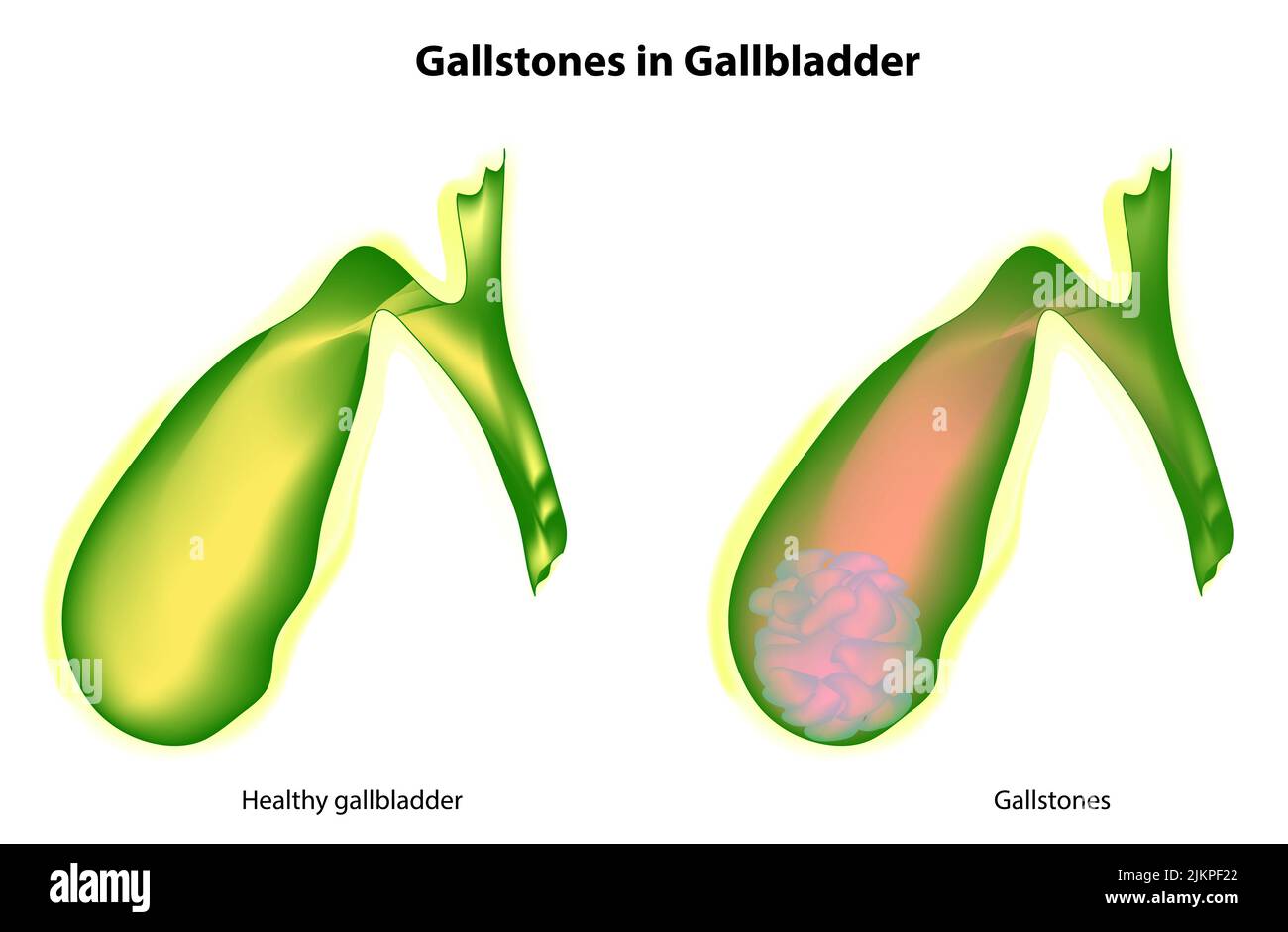 Human gallbladder pancreas anatomy hi-res stock photography and images ...