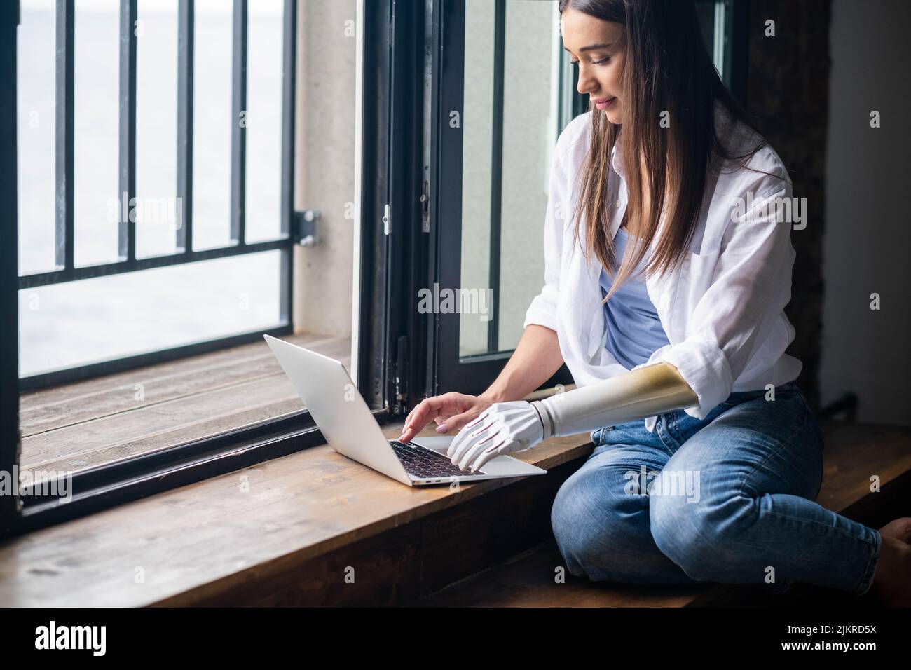 Motivated woman using prosthetic arm working notebook computer, typing ...