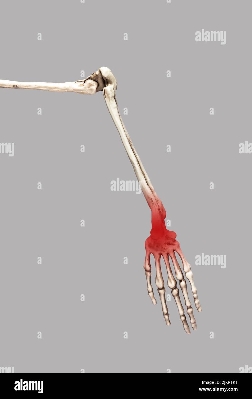Human skeleton arm with red wrist. Sprain, fracture, arthritis ...