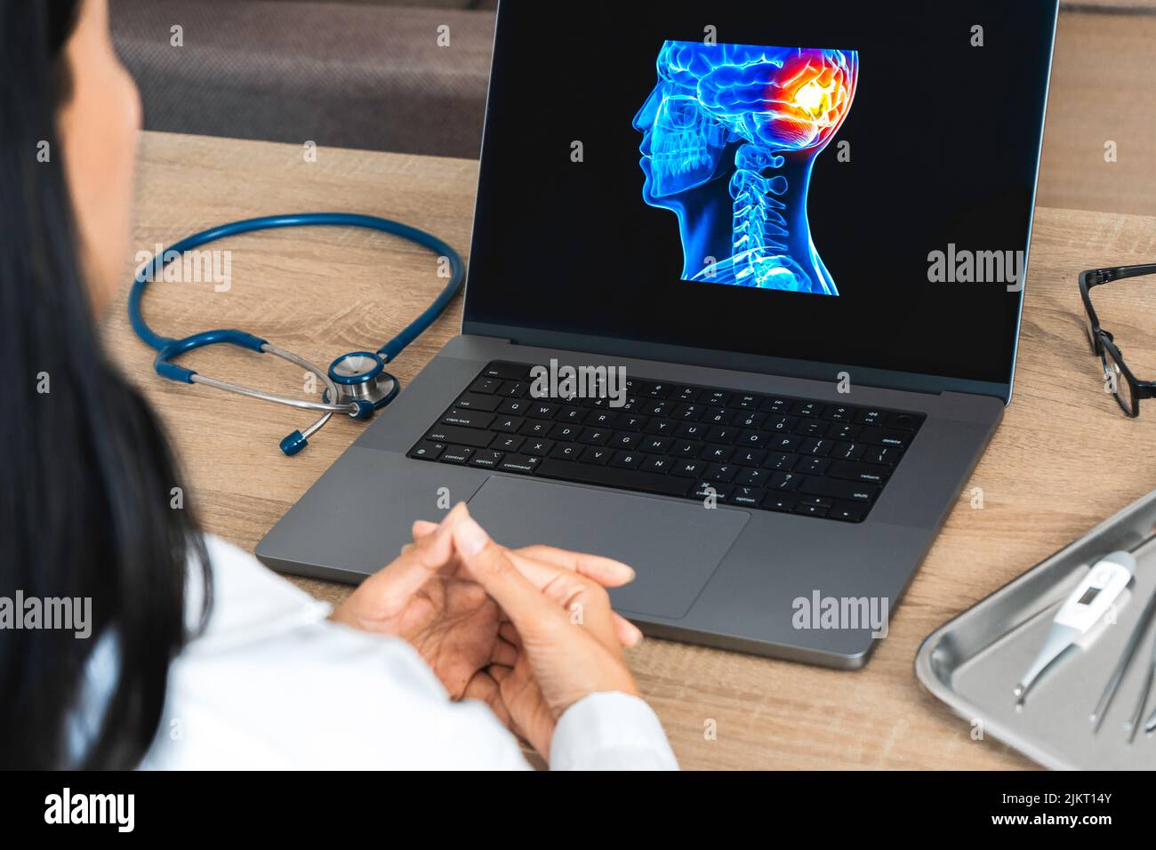 Doctor showing a x-ray of pain in the brain on a laptop. Migraine ...