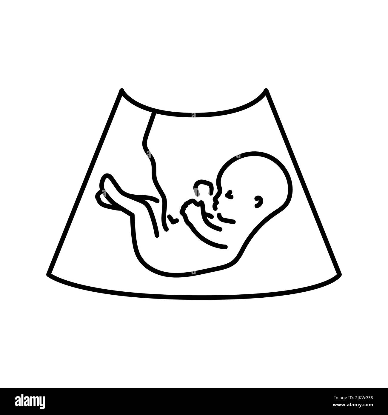 Ultrasound embryo color line illustration. Cosmetology skin care ...