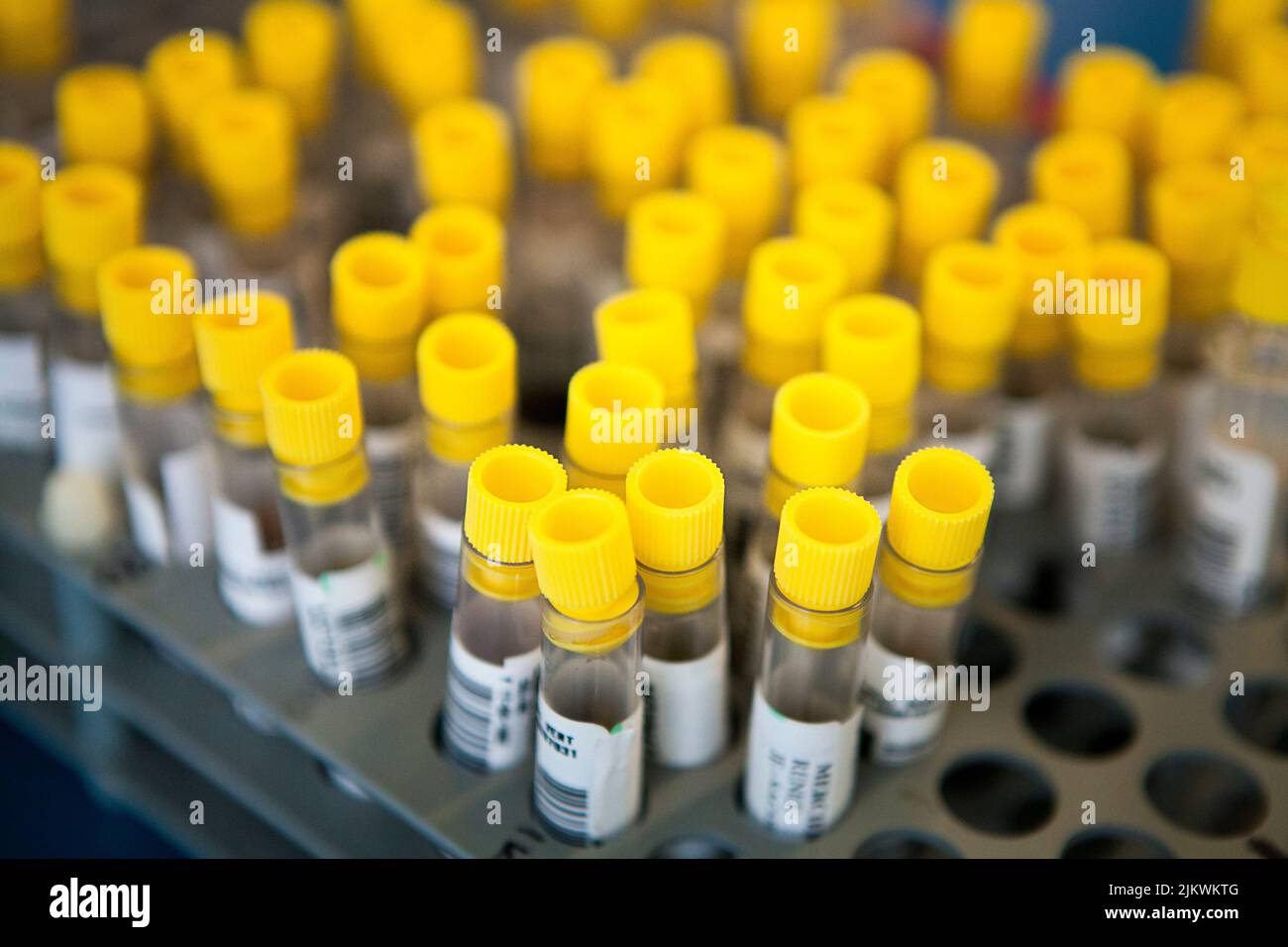 Hospital microbiology analysis laboratory, urine samples Stock Photo ...
