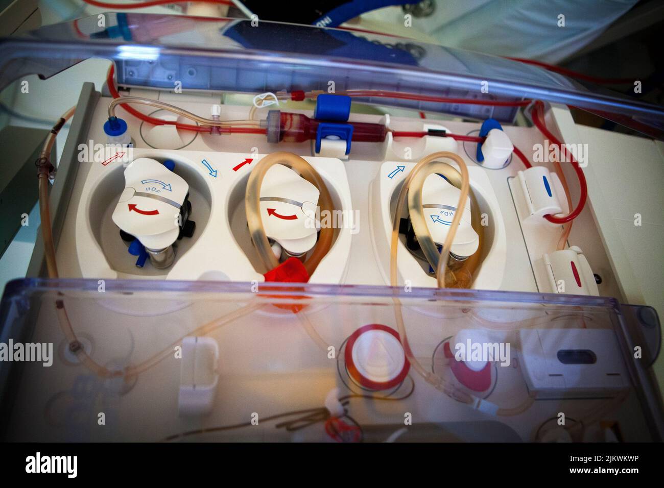 Kidney dialysis machine hi-res stock photography and images - Alamy