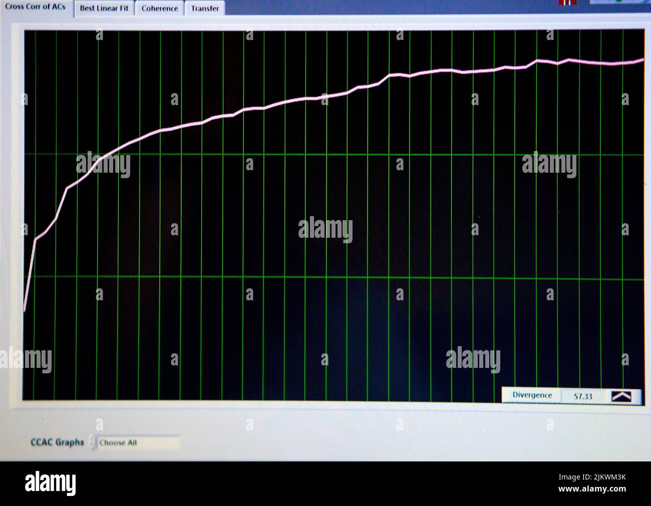 Neurofeedback makes it possible to record the electrical activity of ...