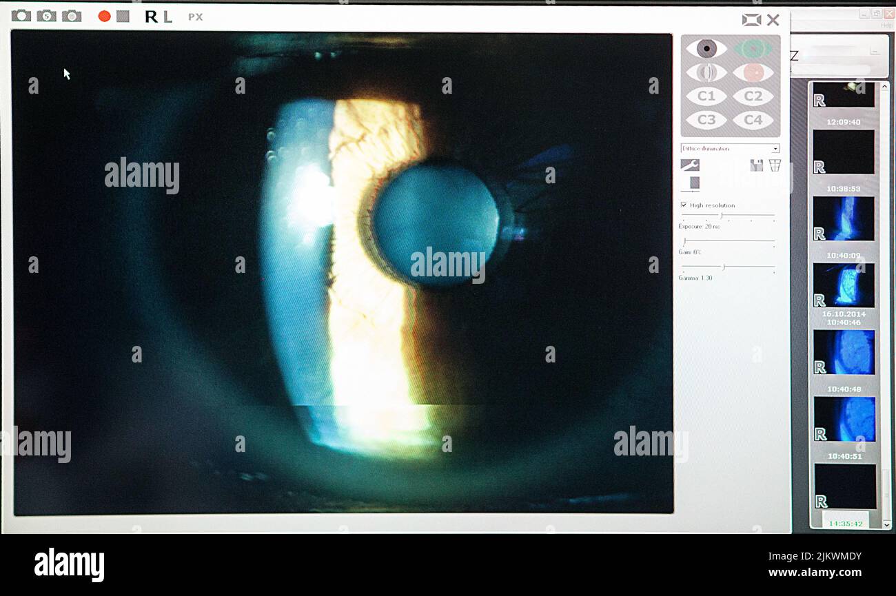 Ophthalmologic image in an ophthalmology practice in Switzerland Stock ...