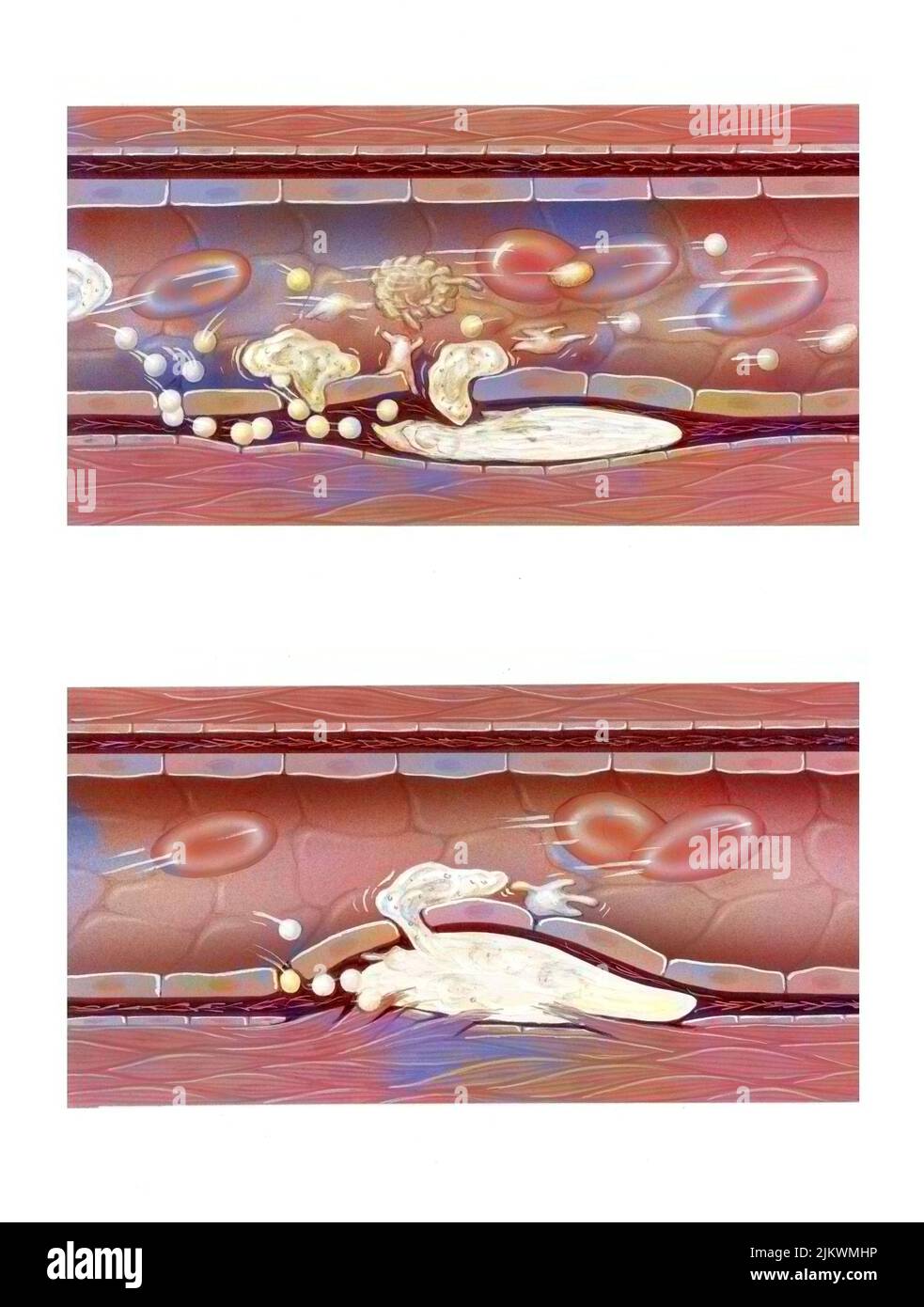 Formation of blood cells hi-res stock photography and images - Alamy