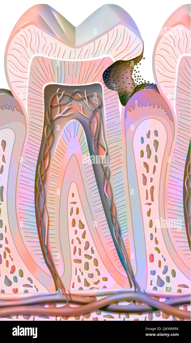 Dentin hi-res stock photography and images - Alamy