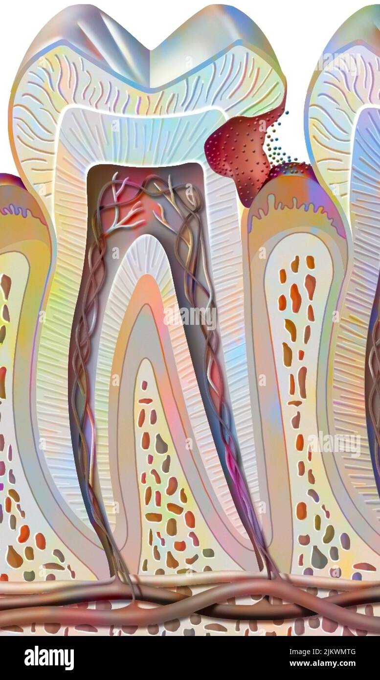 Dentin hi-res stock photography and images - Alamy