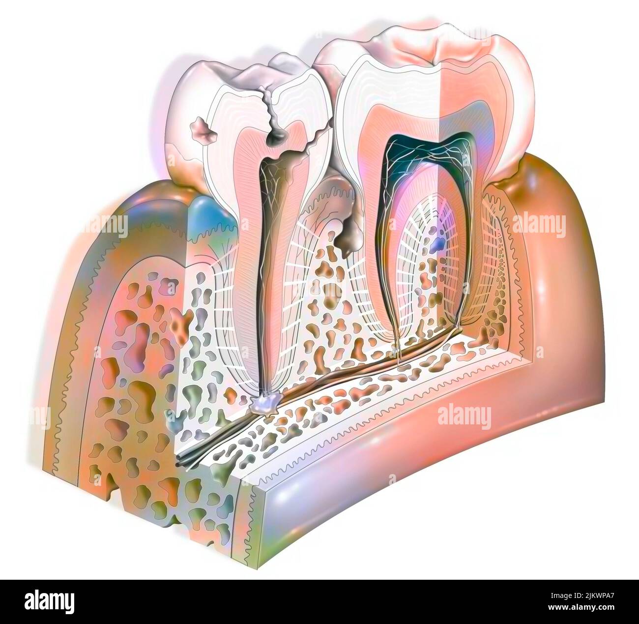 Alveolar abscess Cut Out Stock Images & Pictures - Alamy