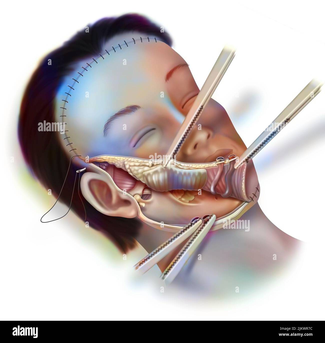 Facial reconstruction drawing Cut Out Stock Images & Pictures - Alamy