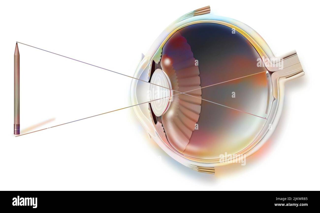 Anatomy of an eye and vision, image reflection (pencil) on the retina ...