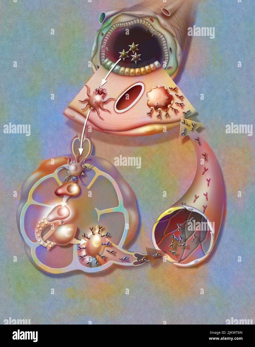 Asthma: sensitization phase during the first contact with the allergen ...