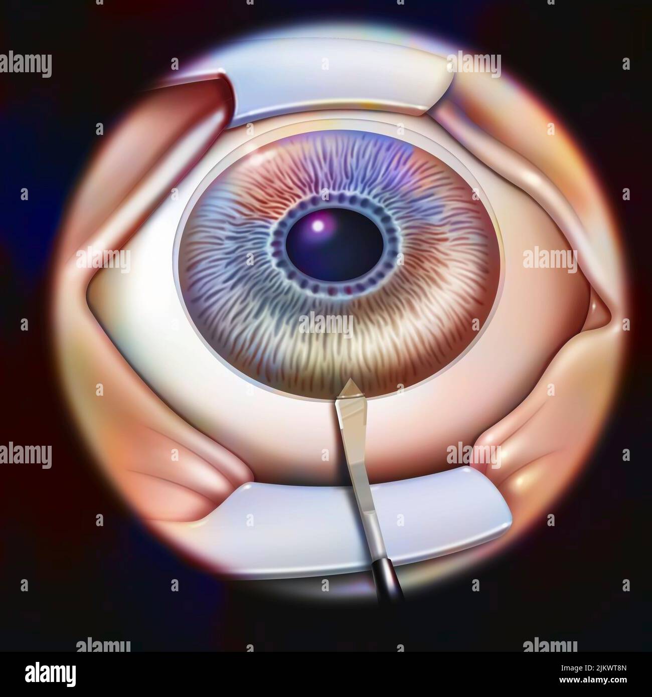 Camera anterior bulbi hi-res stock photography and images - Alamy