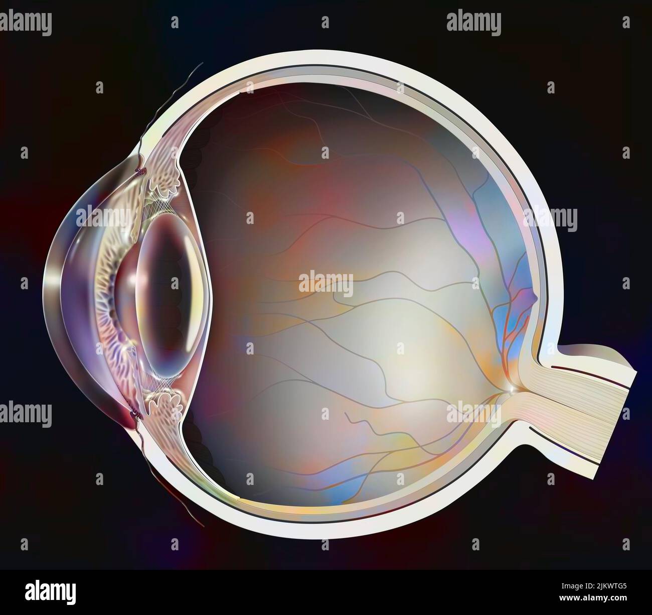 Posterior subcapsular cataract hi-res stock photography and images - Alamy