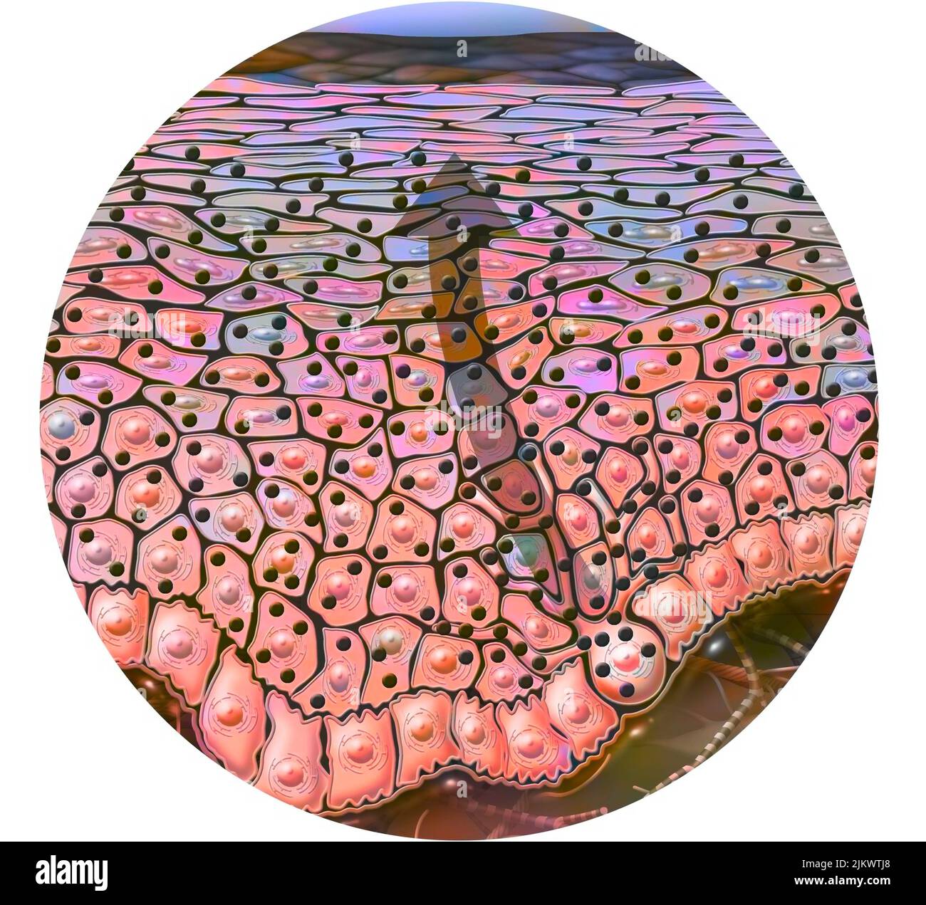 Dark skin type with lots of melanin grains Stock Photo - Alamy