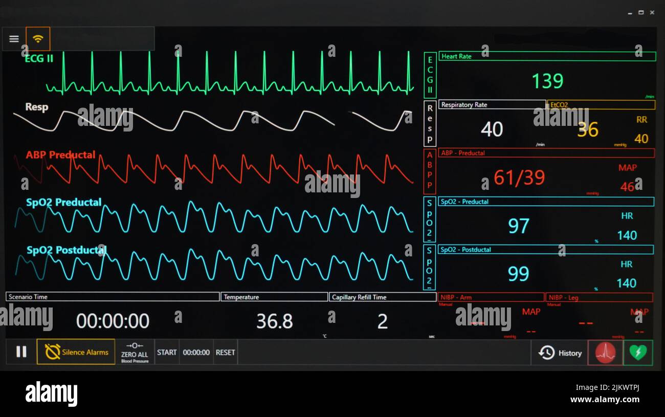 Control room of the pediatric resuscitation simulation course Stock ...