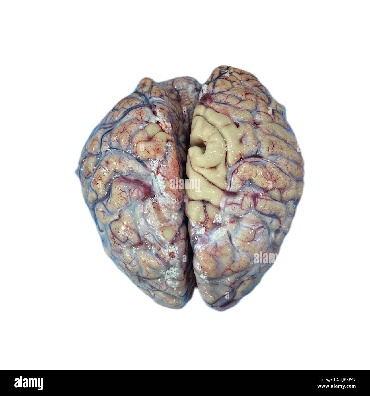 A closeup shot of the human brain on a white background Stock Photo - Alamy