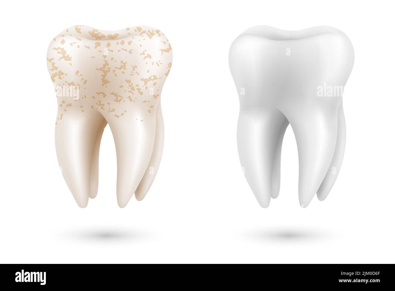 Teeth whitening 3d concept. Comparison of clean and dirty tooth before ...