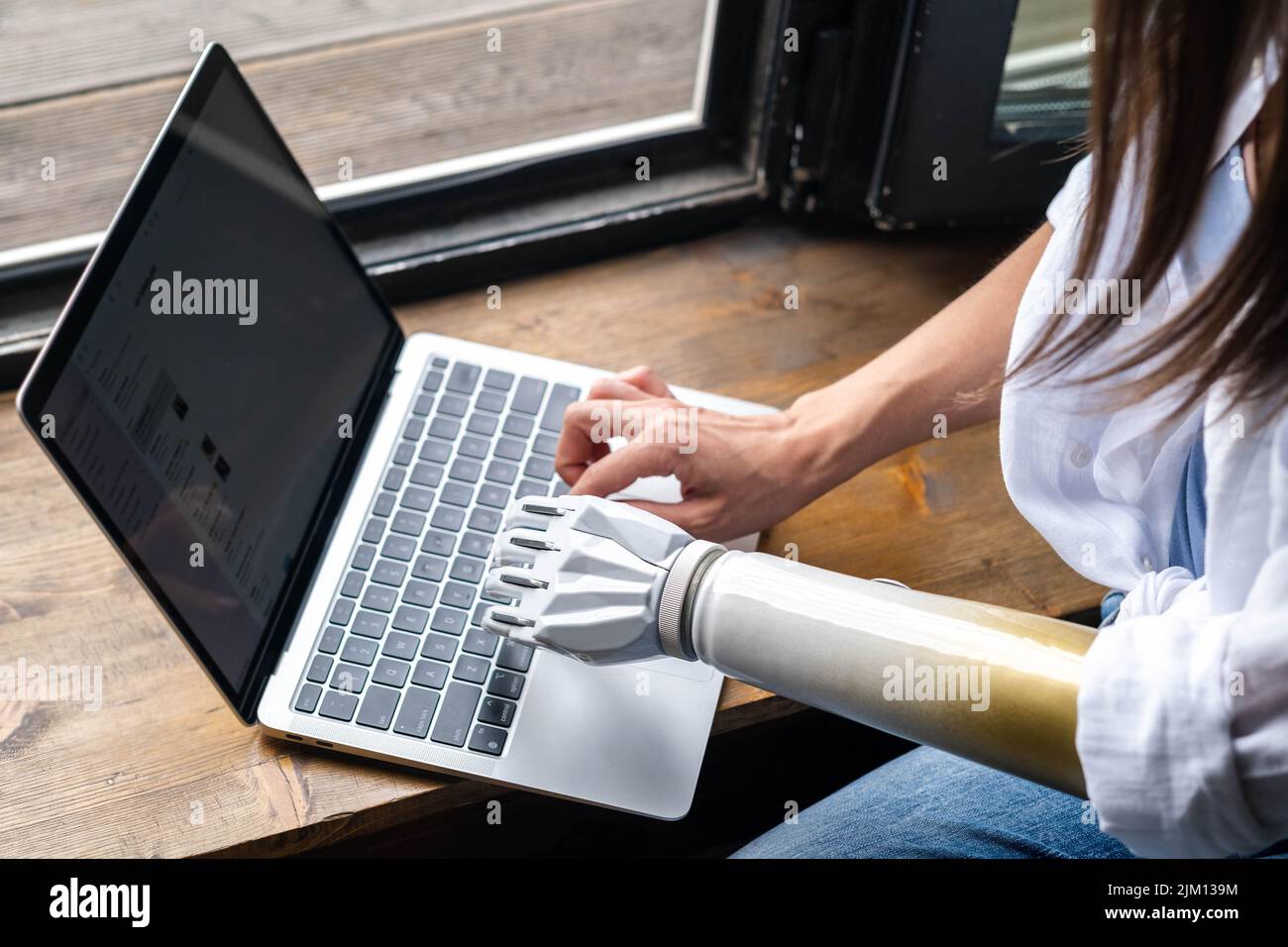 Motivated woman using prosthetic arm working notebook computer, typing ...