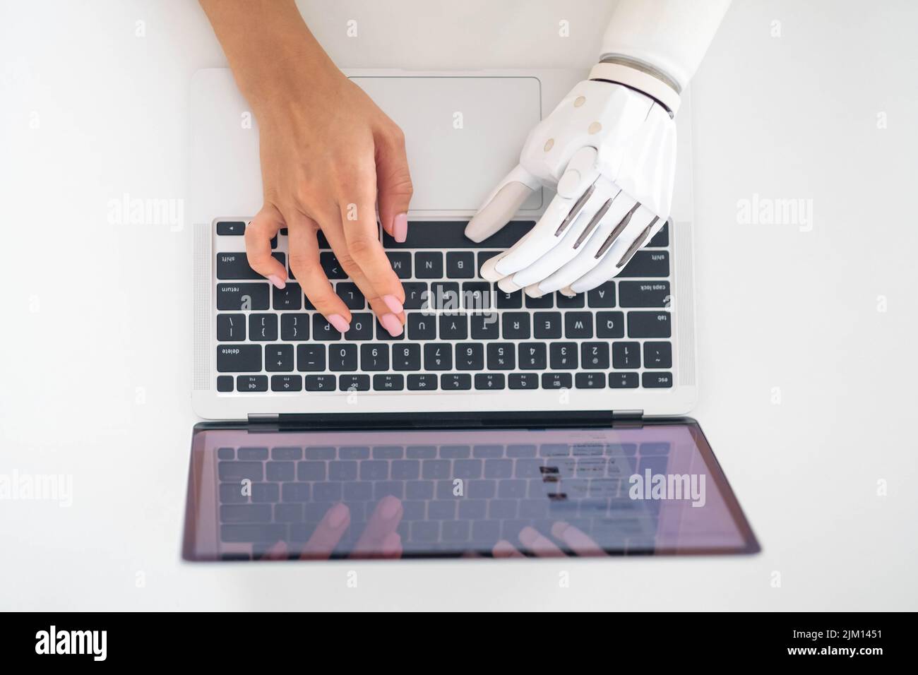 Top view woman using prosthetic arm working notebook computer, typing ...